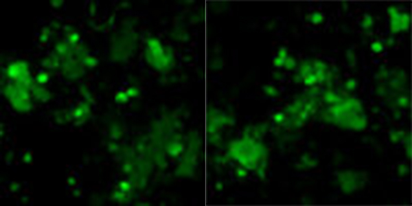 呼吸道合胞病毒RSV-AlibioBuy